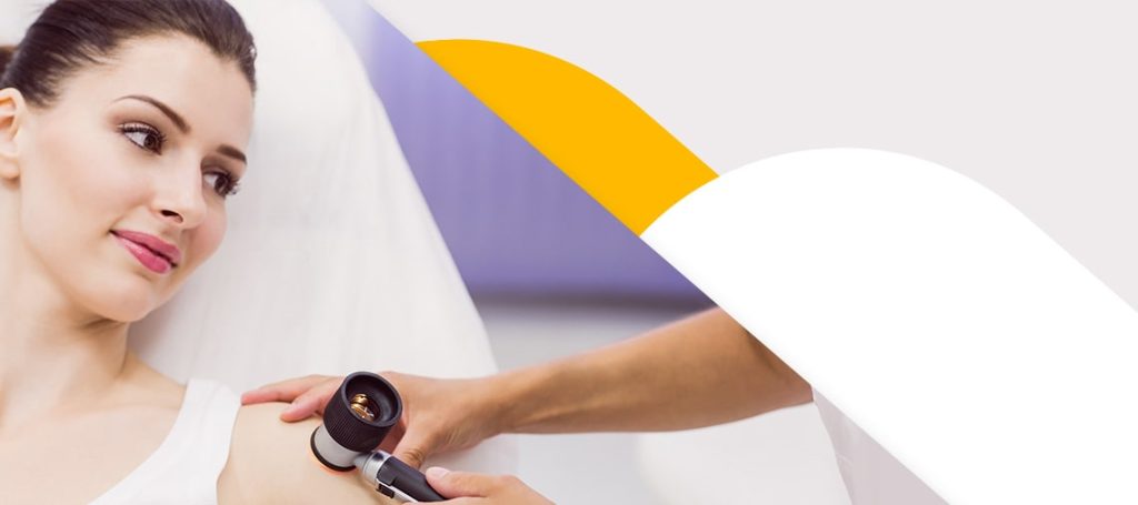 Carcinomul cutanat, cancerul de piele care se poate trata cu succes ...